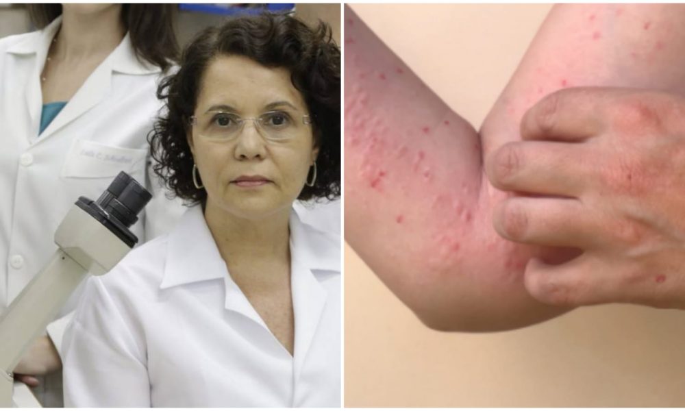 Varíola dos macacos: após confirmação do primeiro caso em Petrópolis ...